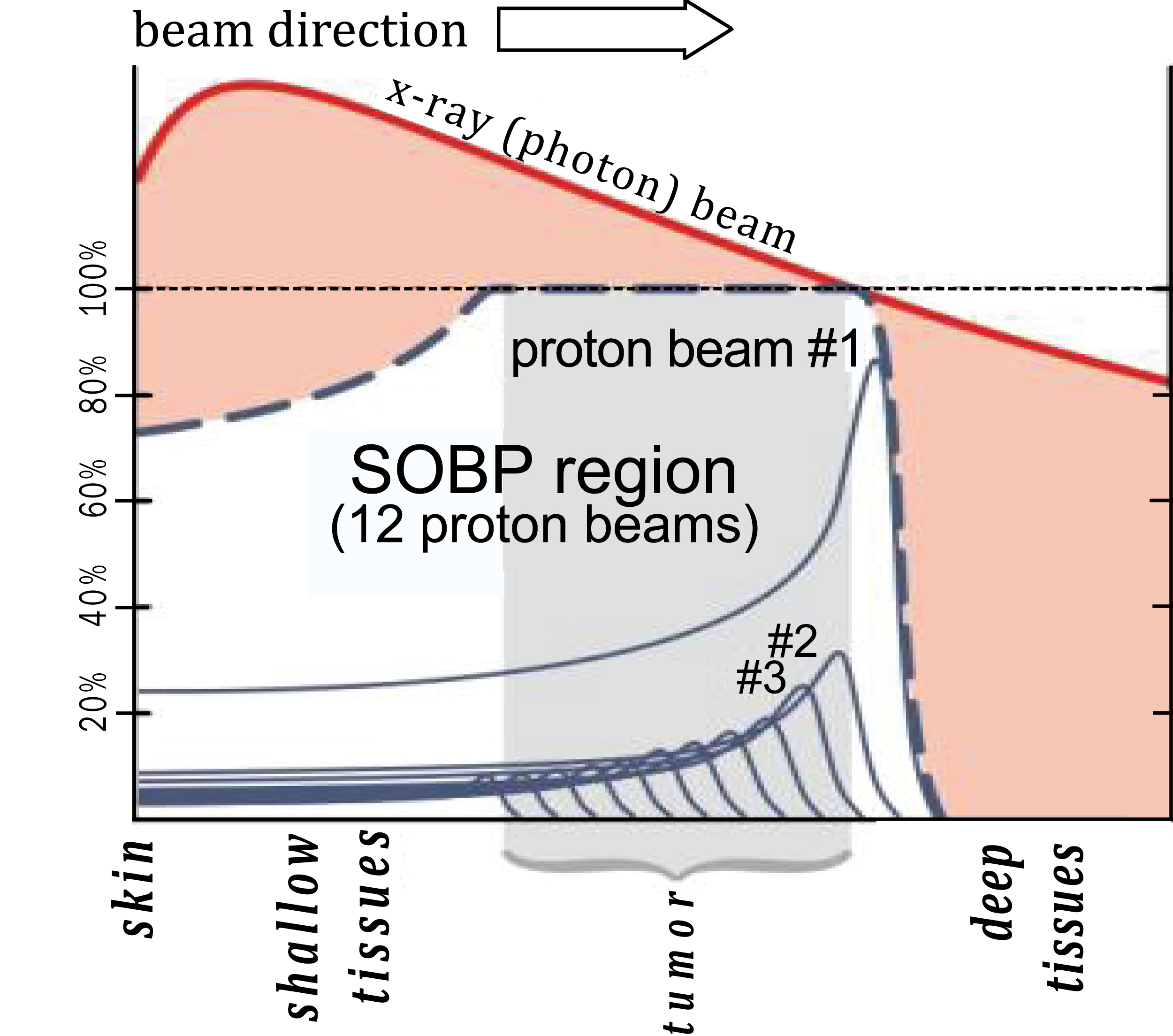 Proton Therapy in the UK