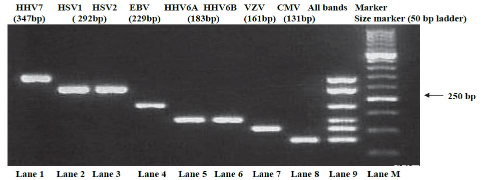 Prevalence of Human Herpesviruses (HHV1-7), and its Clinical ...