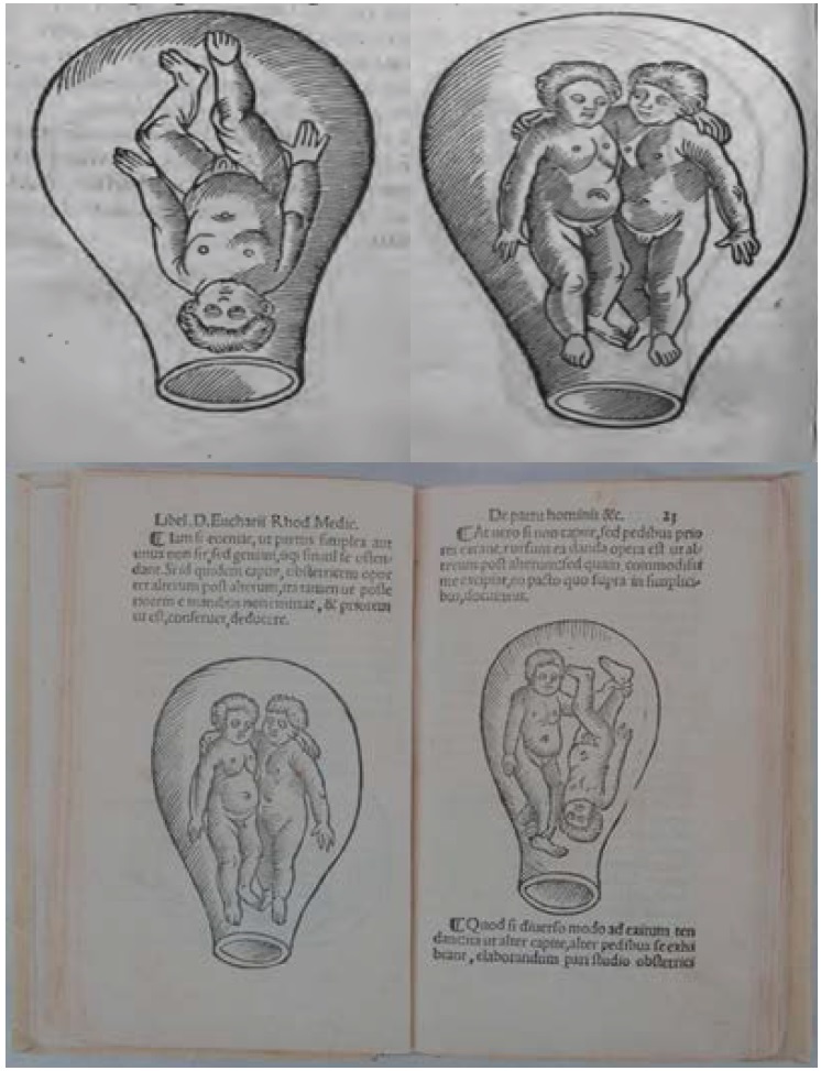 A Brief Historical Survey of the Illustrations of the Positions of the ...